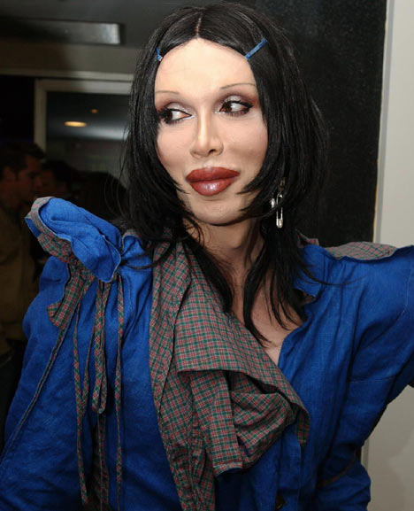 Pete burns sues for Botched Lips : Singer Addicted to Plastic Surgery ...