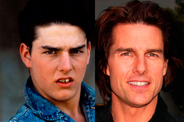 10 celebs who used to have horrible smiles (Photo) - Canada Journal ...