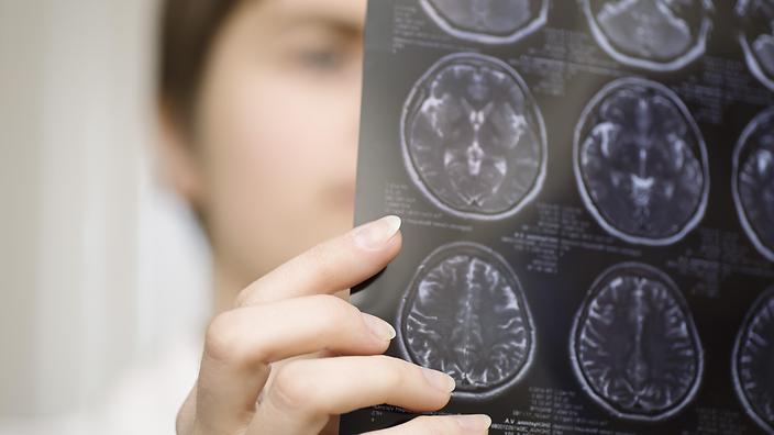 MS Cancer Treatment: Multiple sclerosis patients may walk again ...